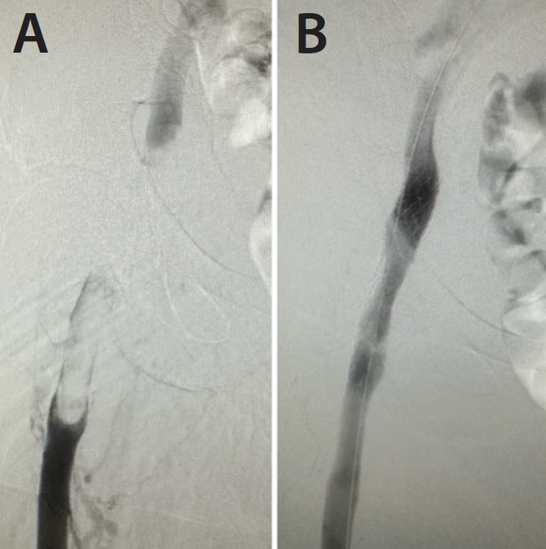 Lightning Bolt™ 7 and Lightning Flash™: The Next Generation of CAT ...