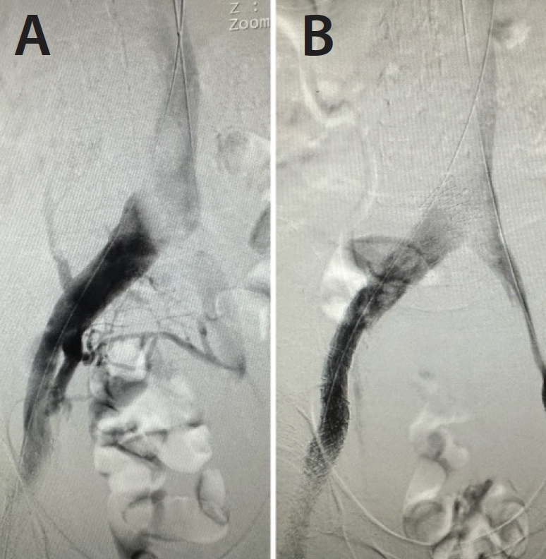 Lightning Bolt™ 7 and Lightning Flash™: The Next Generation of CAT ...