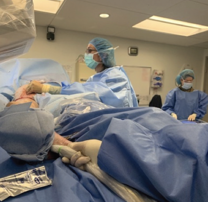 Pedal Acceleration Time Technique for Assessing Revascularization ...