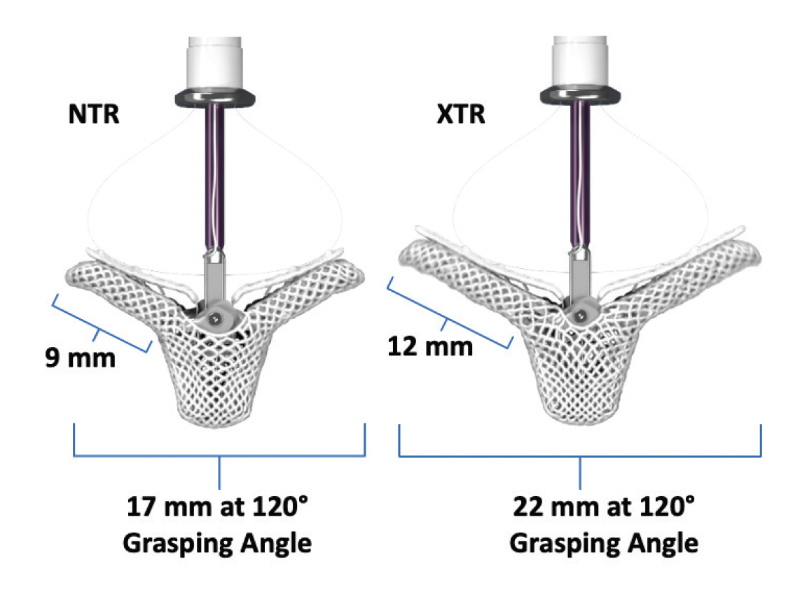 Design, Development, and Clinical Experience of Four MitraClip™ Device ...