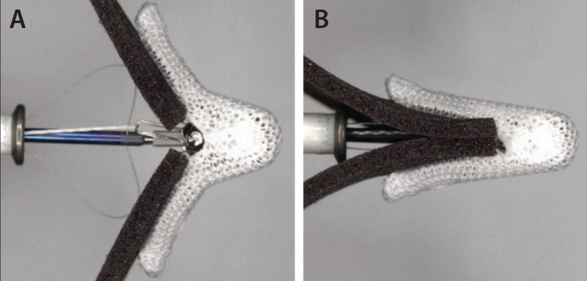 Therapeutic Benefits of TEER With the MitraClip™ Device - Cardiac ...