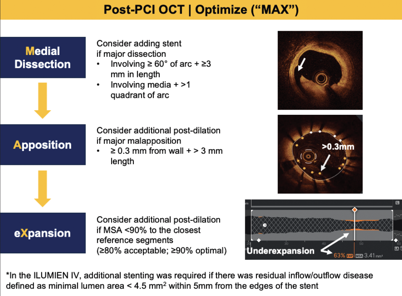 OCT-Guided PCI: Lessons From the ILUMIEN IV: OPTIMAL PCI Trial - Cardiac Interventions Today