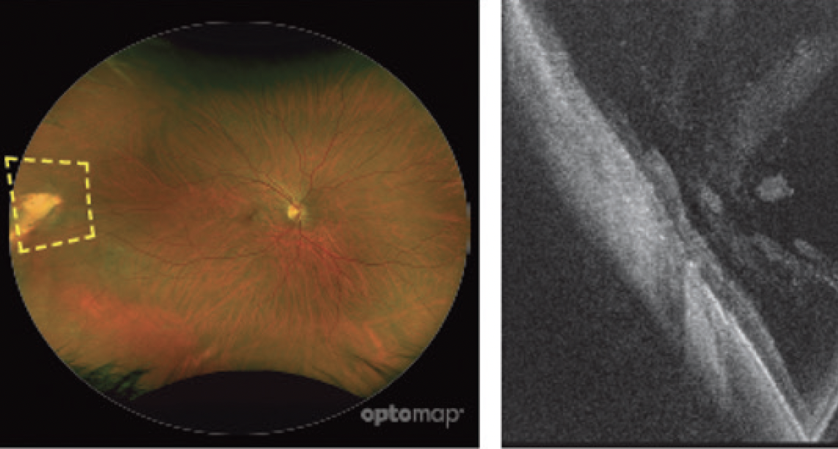 A New Era of Diagnostic Technologies - Modern Optometry