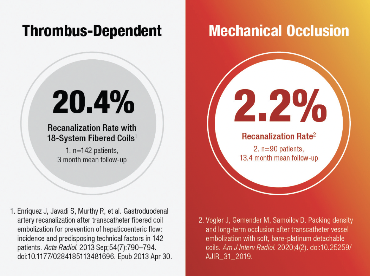 Penumbra Embolization Platform: A Coil for Every Case - Endovascular Today