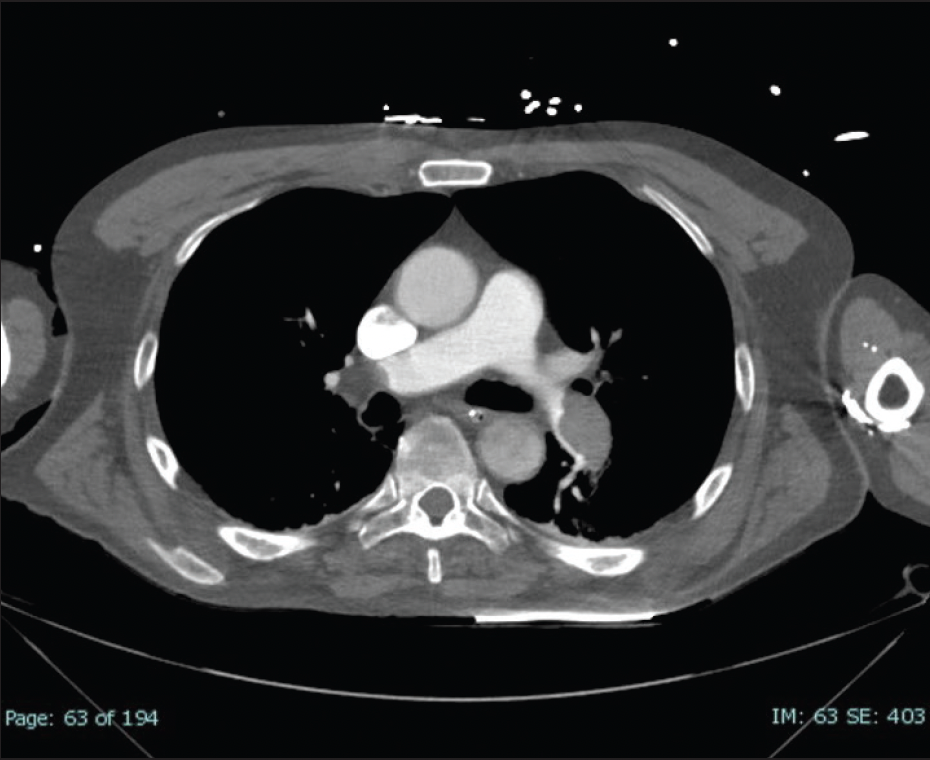 Safety. Effectiveness. Evidence. SEE Why Inari Is the Preferred Choice ...