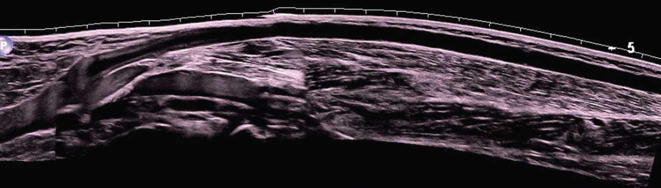Current Diagnostic Strategies for Superficial Venous Insufficiency ...
