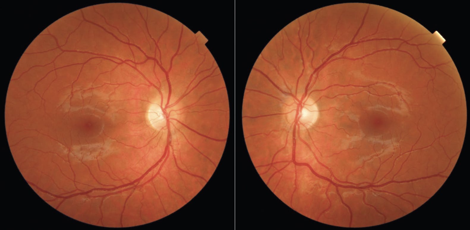 Let It Snow - Modern Optometry