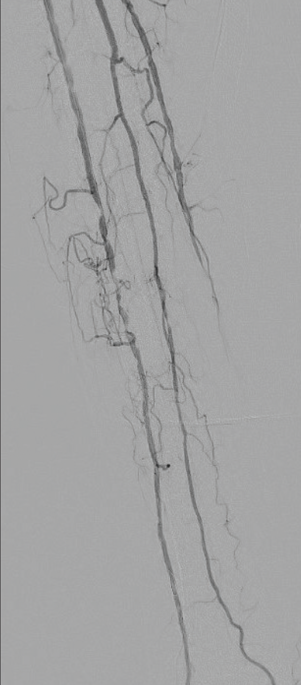 Shockwave E8: Extend Your Capabilities With the New Peripheral IVL ...
