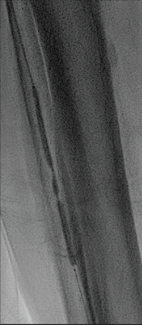 Shockwave E8: Extend Your Capabilities With the New Peripheral IVL ...