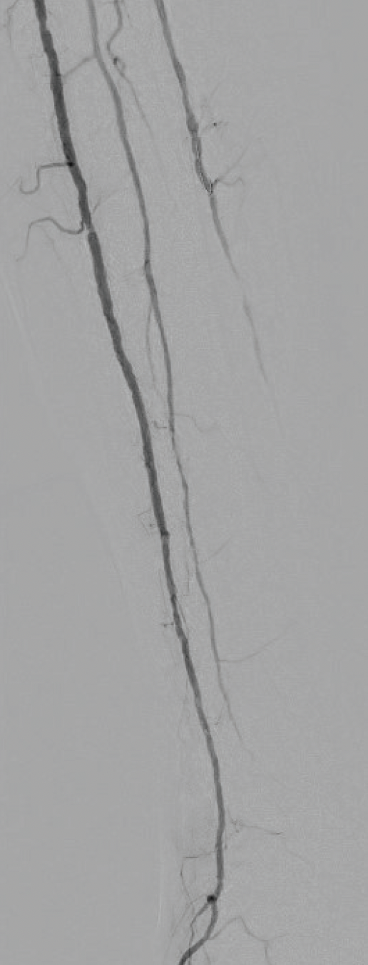 Shockwave E8: Extend Your Capabilities With the New Peripheral IVL ...