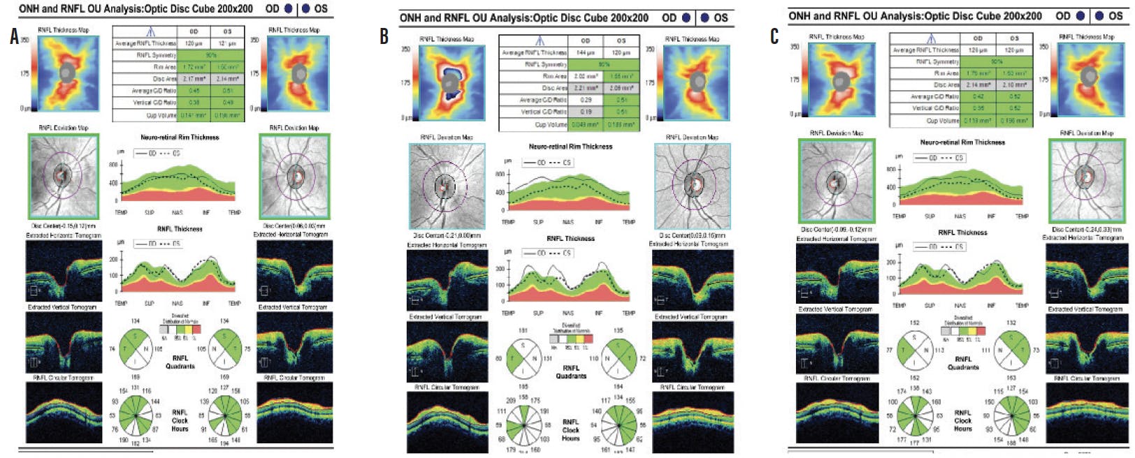 Double Whammy - Modern Optometry
