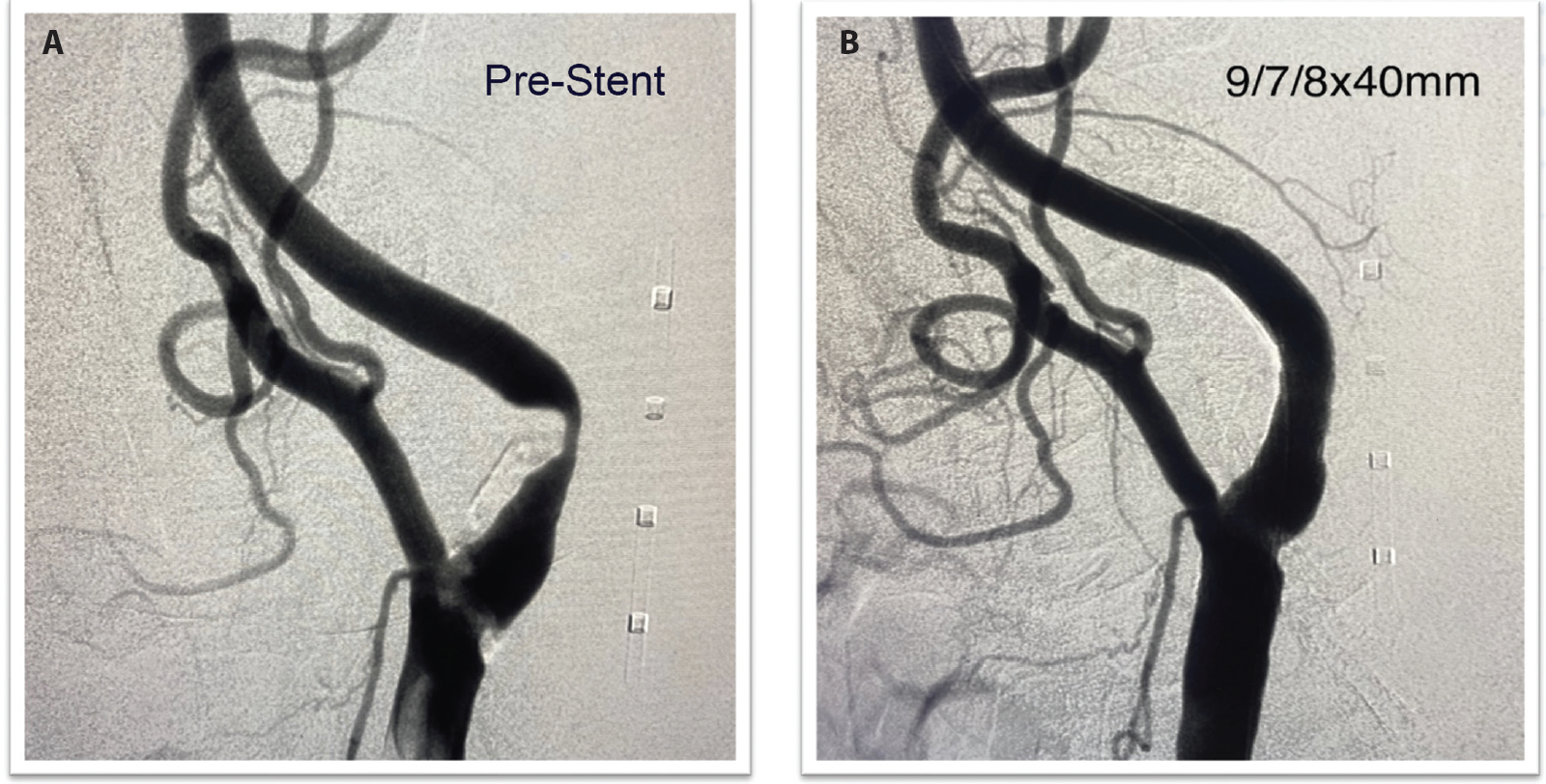 Embracing a New Era: Putting Data Into Practice - Endovascular Today