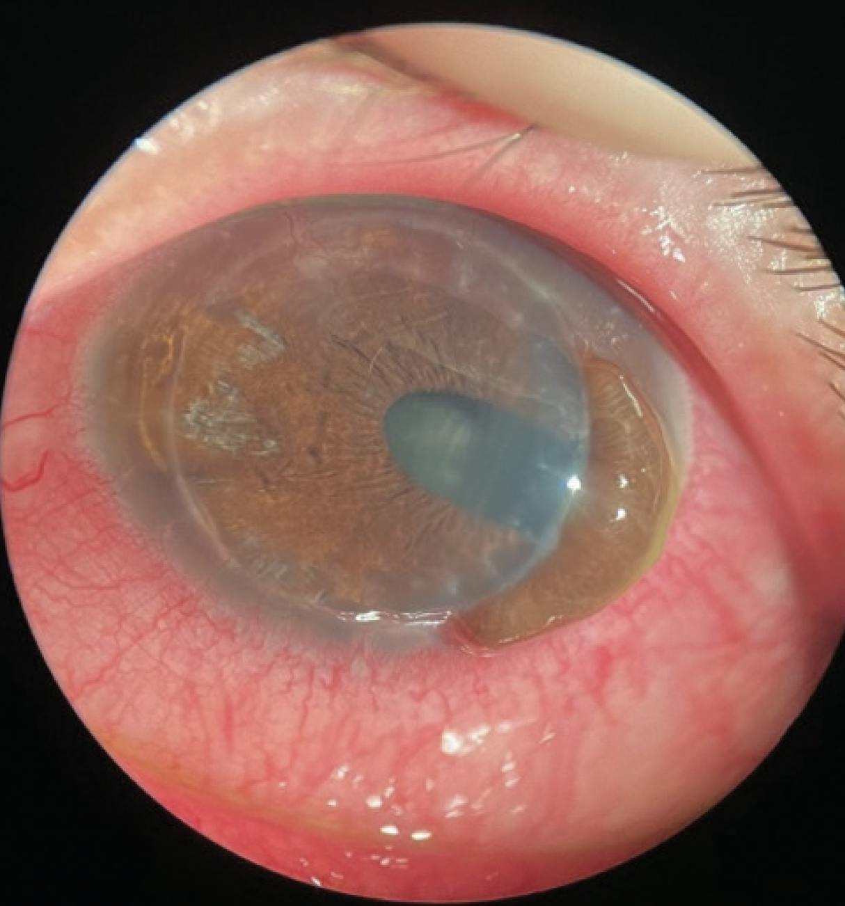 Lessons From the Trauma Unit - Modern Optometry