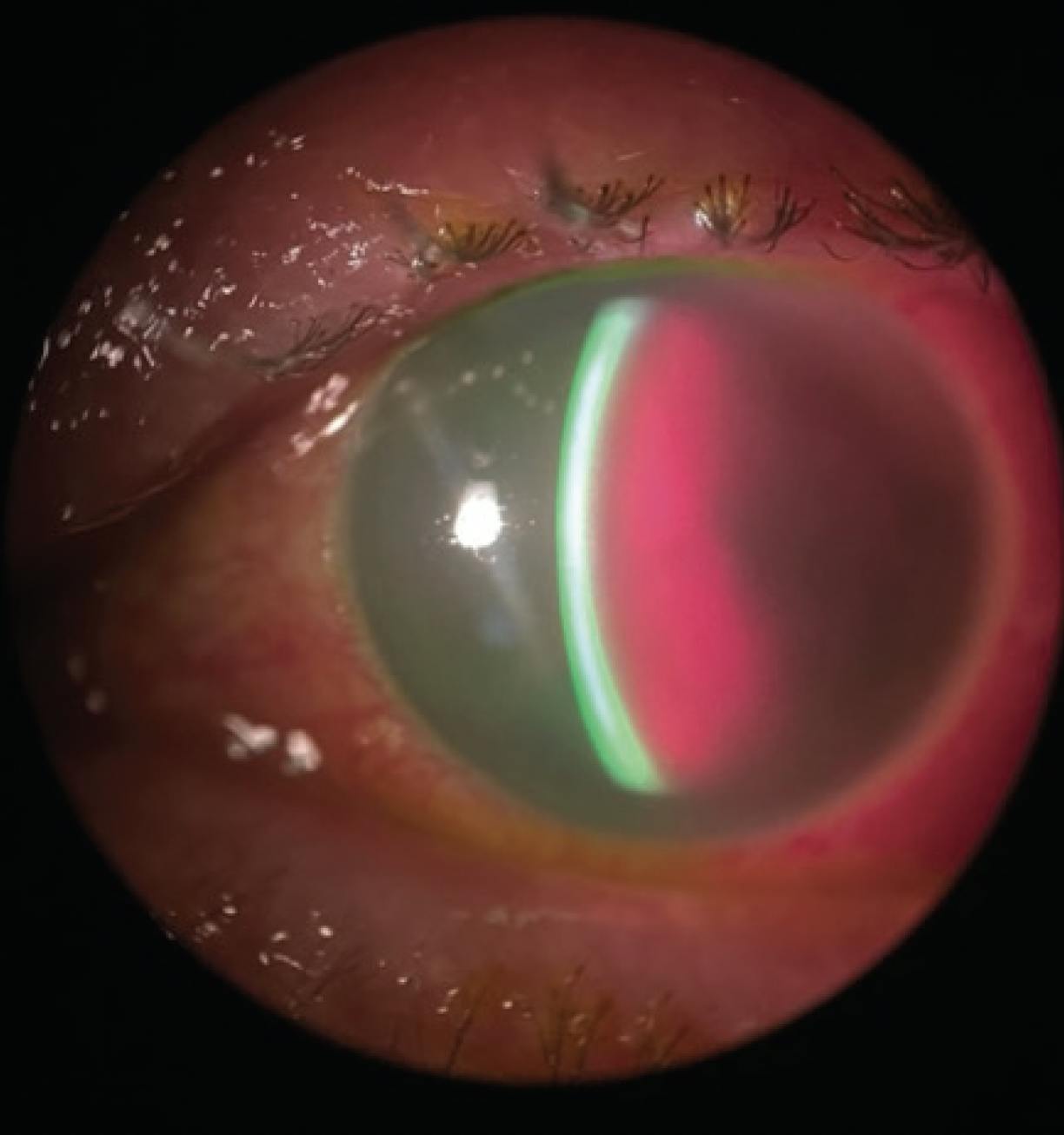 Lessons From the Trauma Unit - Modern Optometry