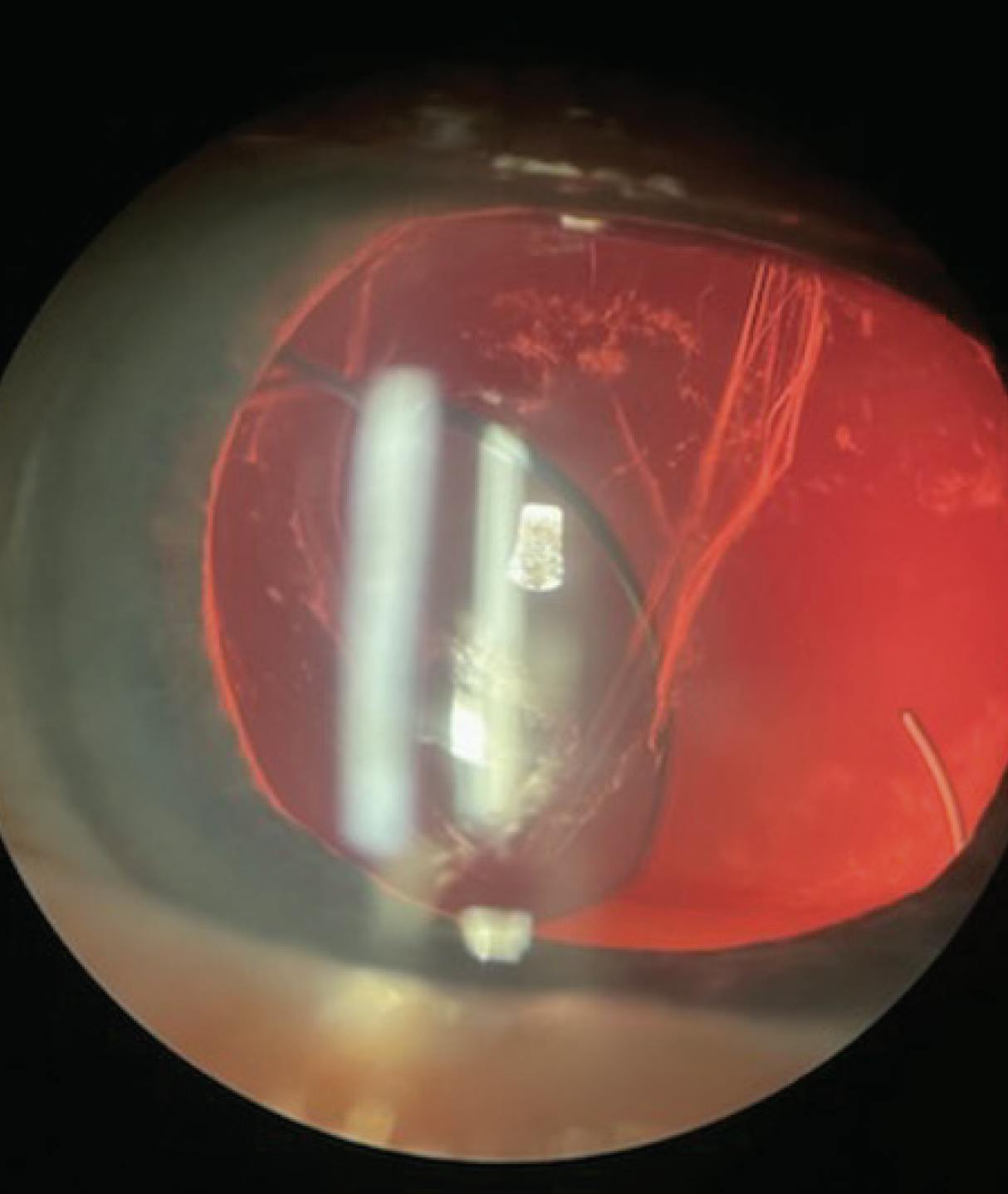 Lessons From the Trauma Unit - Modern Optometry