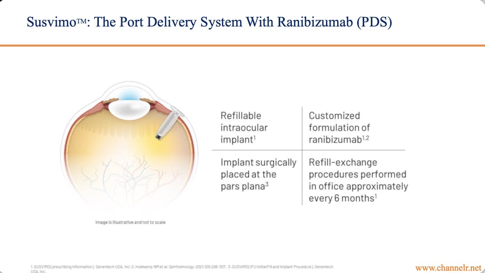The PDS: Design, Data, and Durability - Eyetube