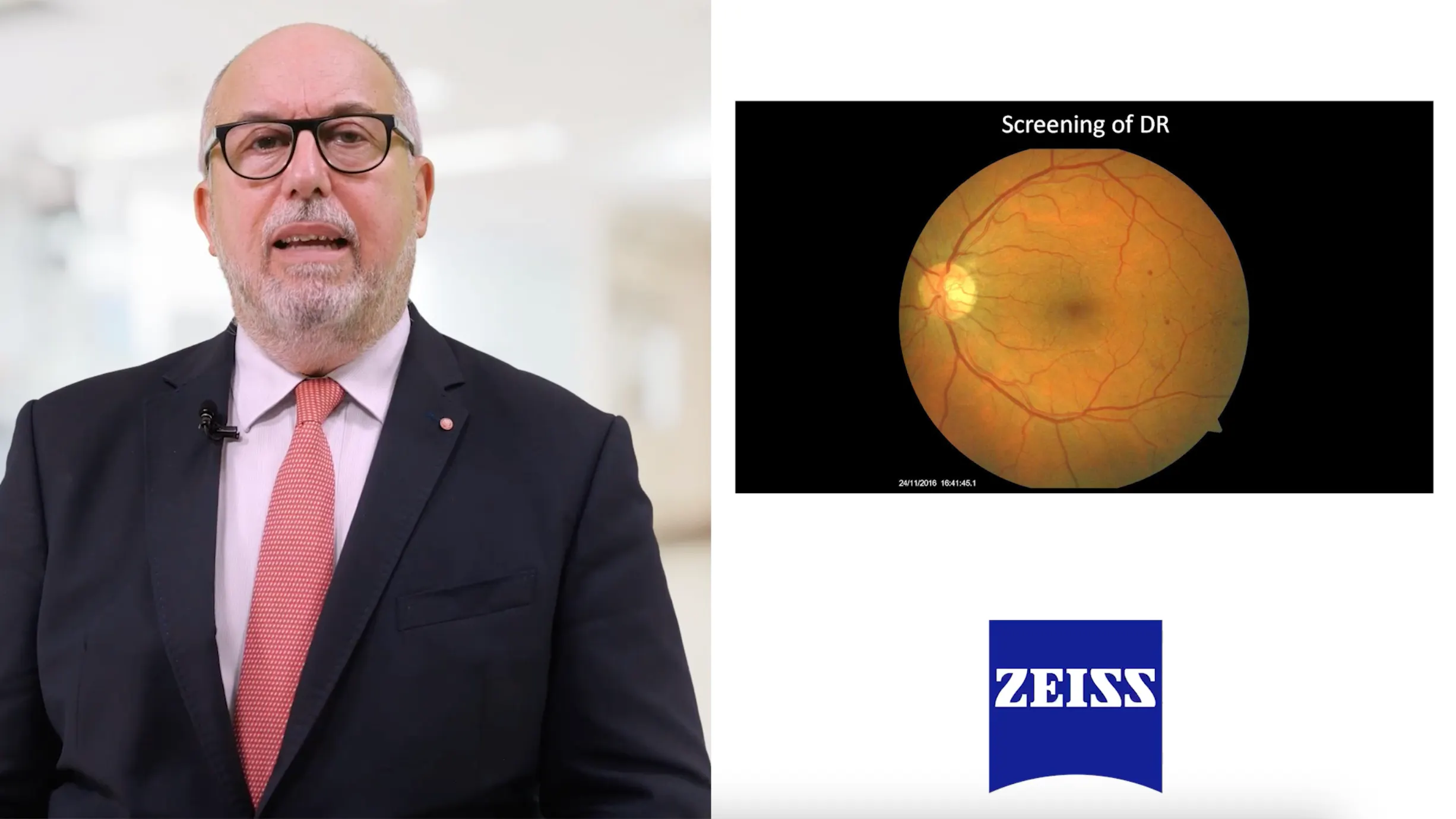 Imaging of the Fundus in Diabetes - Eyetube