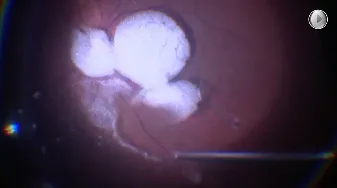 Light Pipe - Eyetube