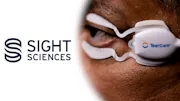 Novartis Acquires Gene Therapy Company Gyroscope Therapeutics - Eyewire+