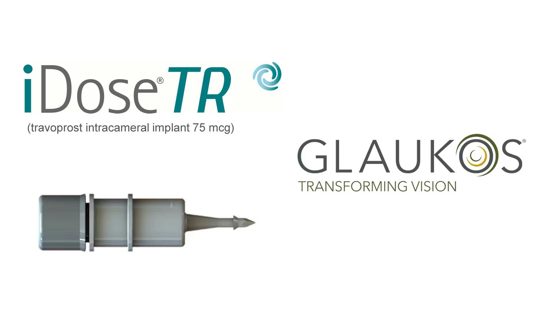 Glaukos Begins Rollout of iDose TR in the US - Eyewire+