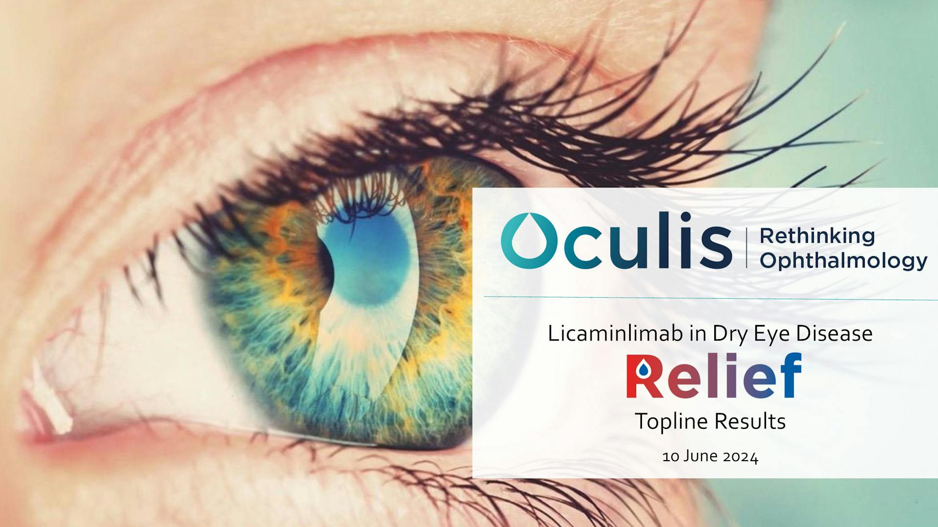Oculis Provides Clinical Data and Update on DED Candidate Licaminlimab ...