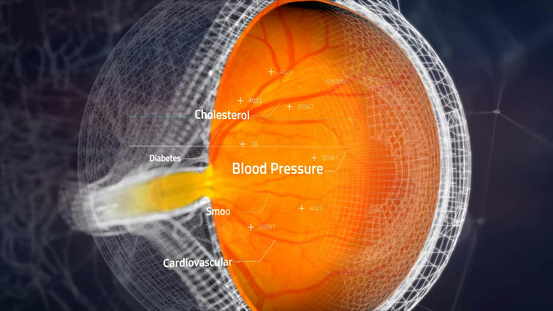 Identifying Cardiovascular Disease Through the Eye - Eyewire+