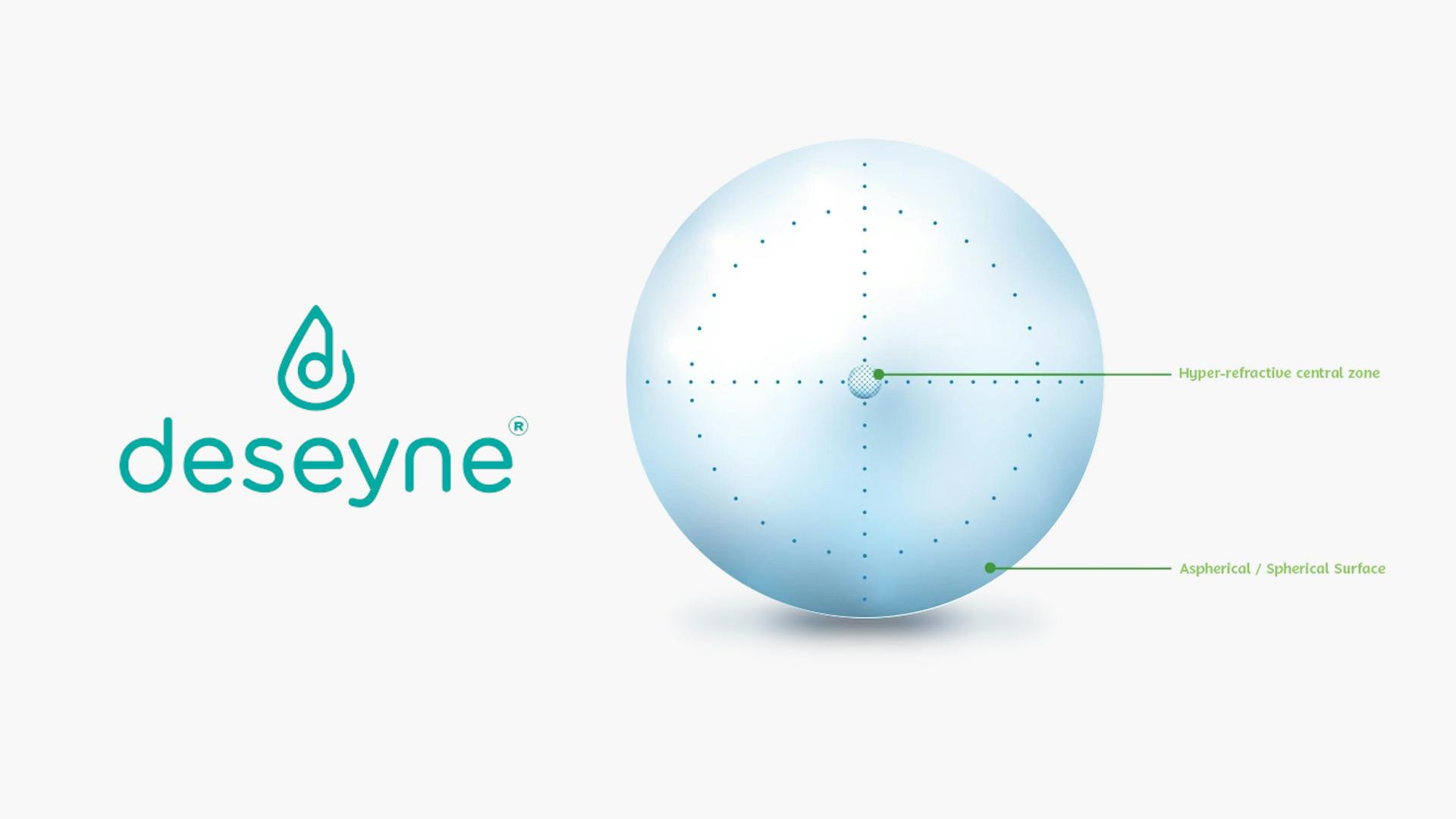 FDA Clears First Daily Disposable Soft EDOF Contact Lens for Presbyopia ...