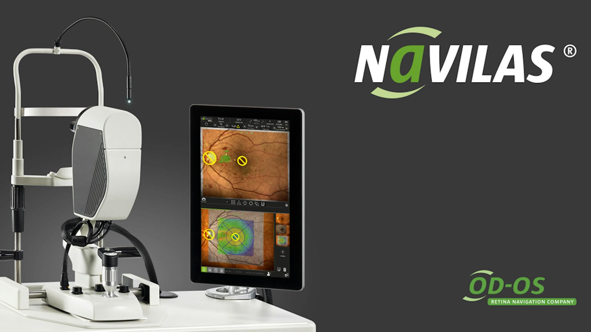 OD-OS Introduces Teleguidance Software for the Navilas 577s - Eyewire+
