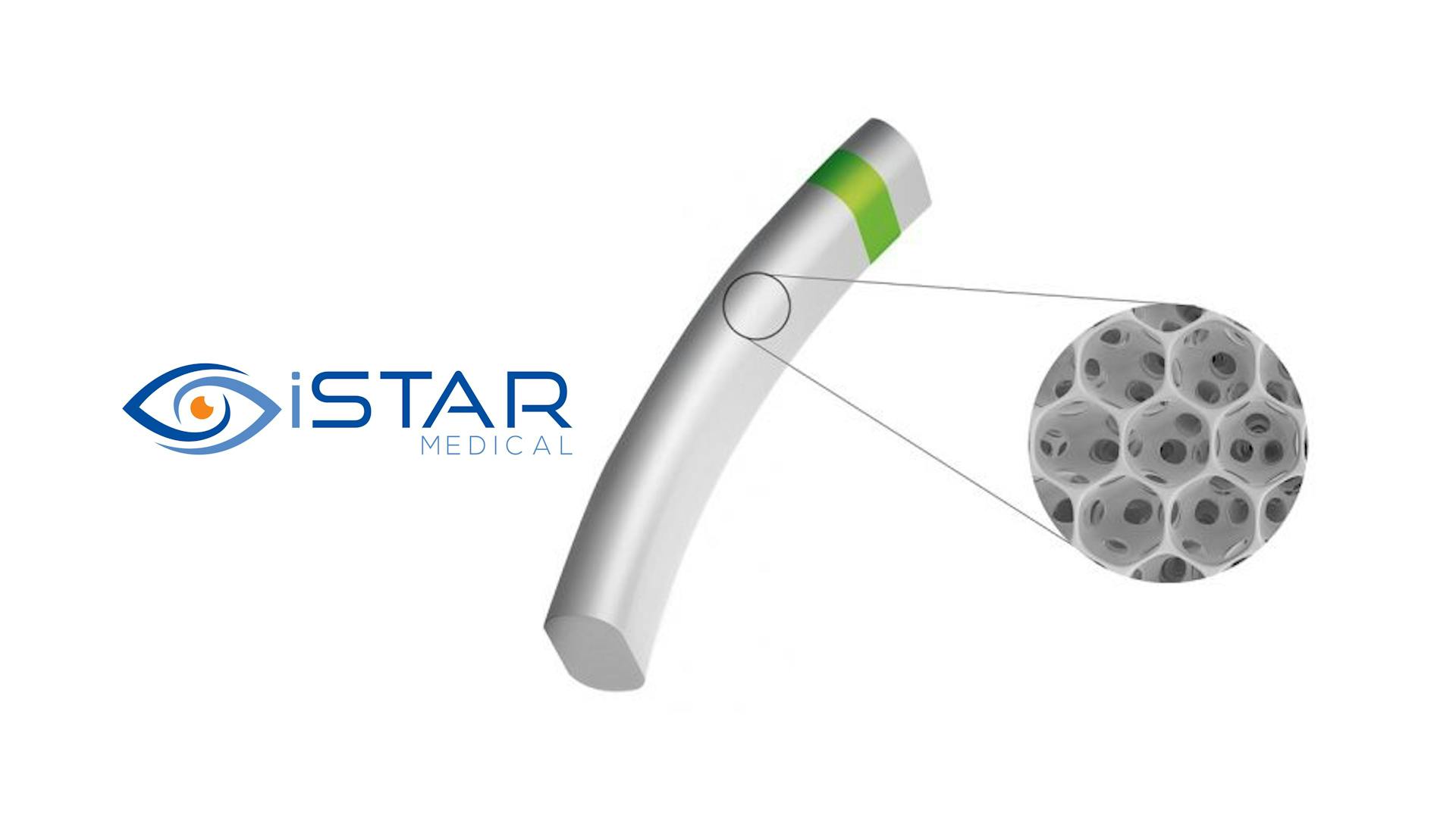 iSTAR Medical's MINIject MIGS Device Approved in Europe - Eyewire+