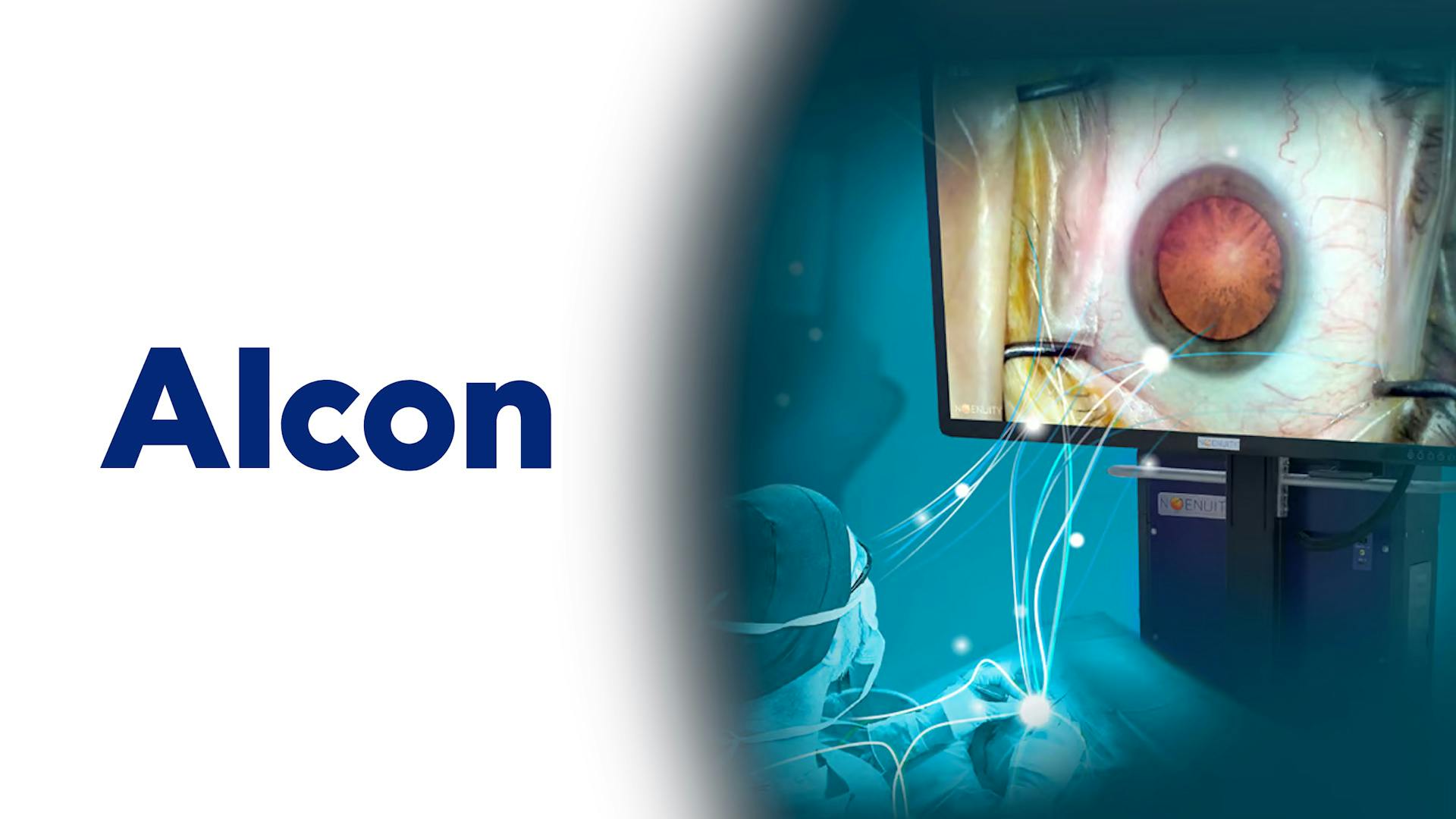 Alcon NGENUITY 1.5 - Eyewire+