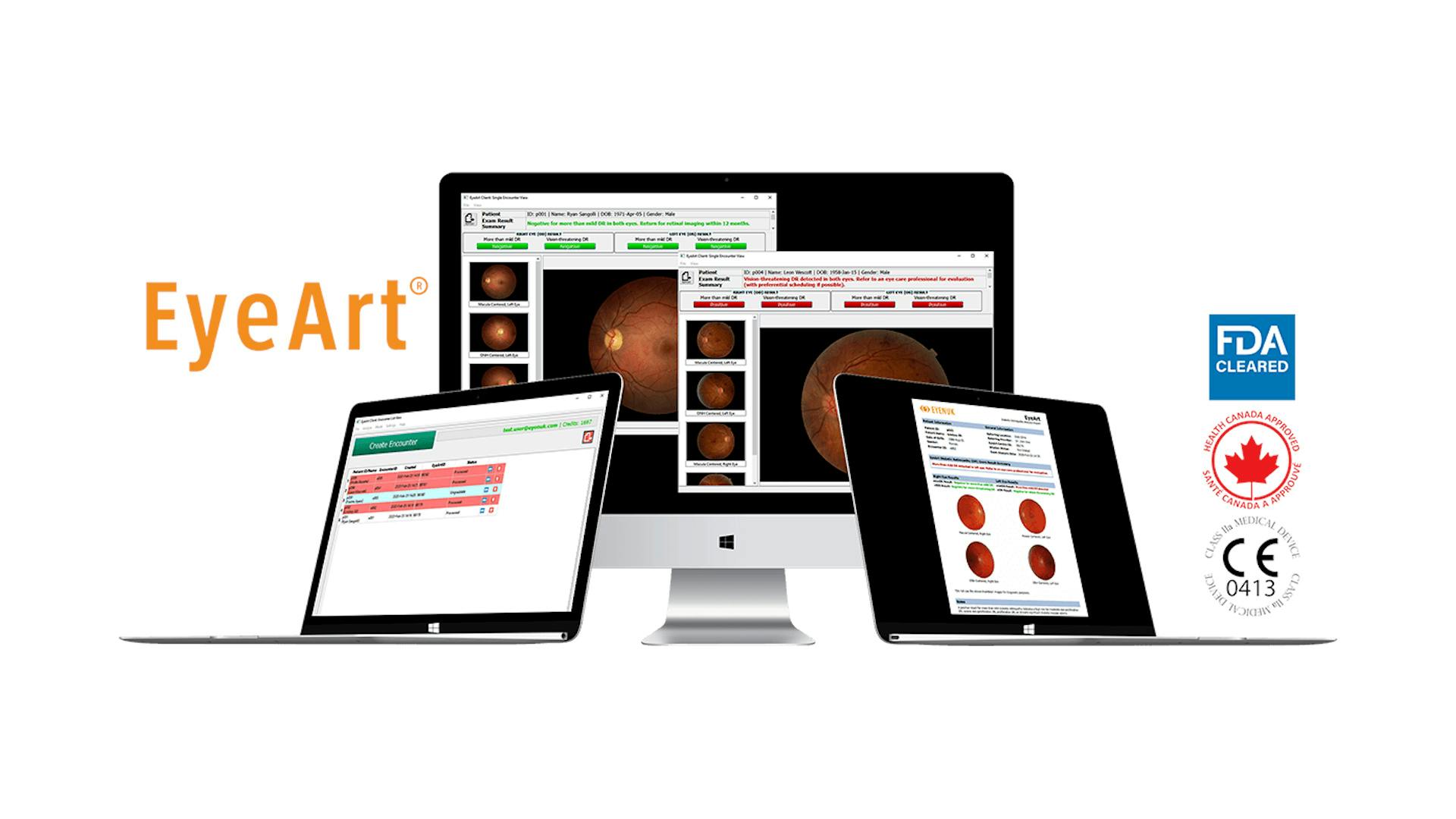 Eyenuk Receives Another FDA Clearance for EyeArt AI System for DR Detection - Eyewire+