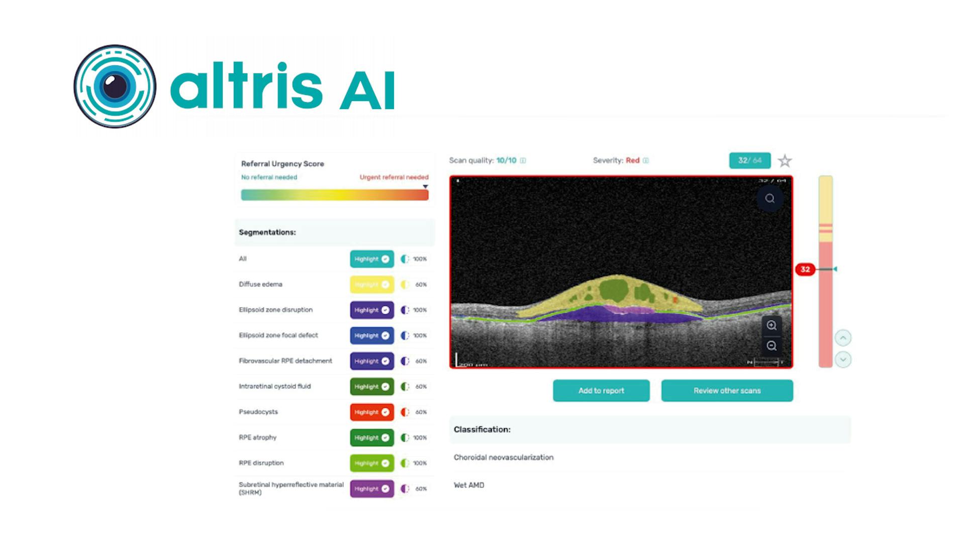 FDA Clears Altris IMS Platform for OCT Scan Analysis - Eyewire+