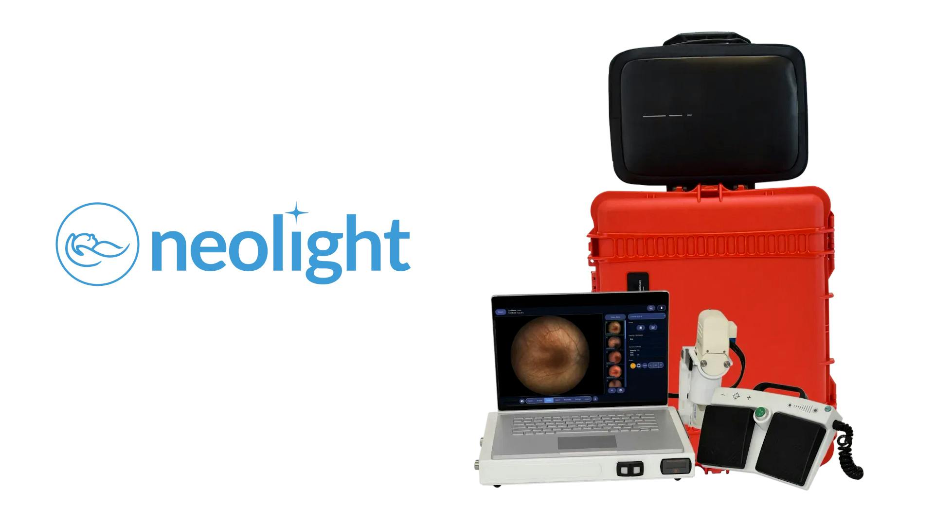 FDA Clears NeoLight's Icon Go Portable Retinal Imaging System with ...