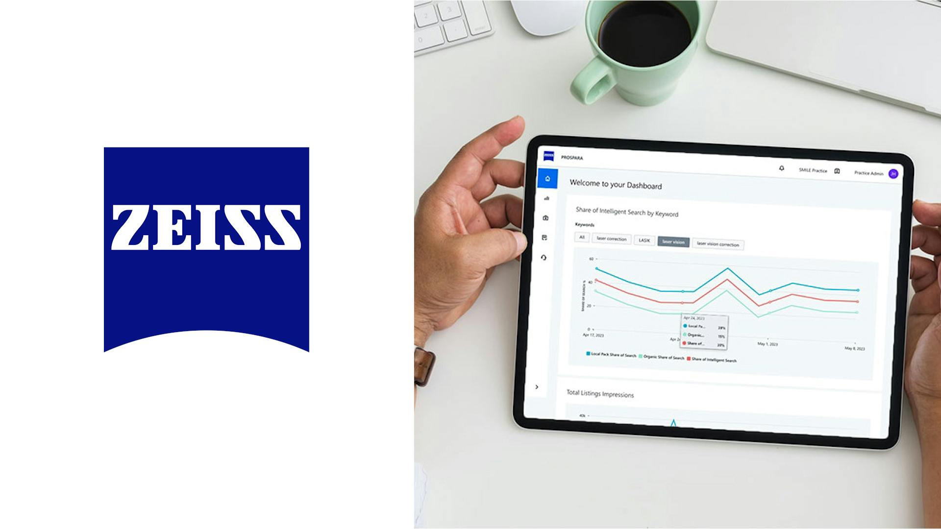 Alcon SMARTCataract - Eyewire+