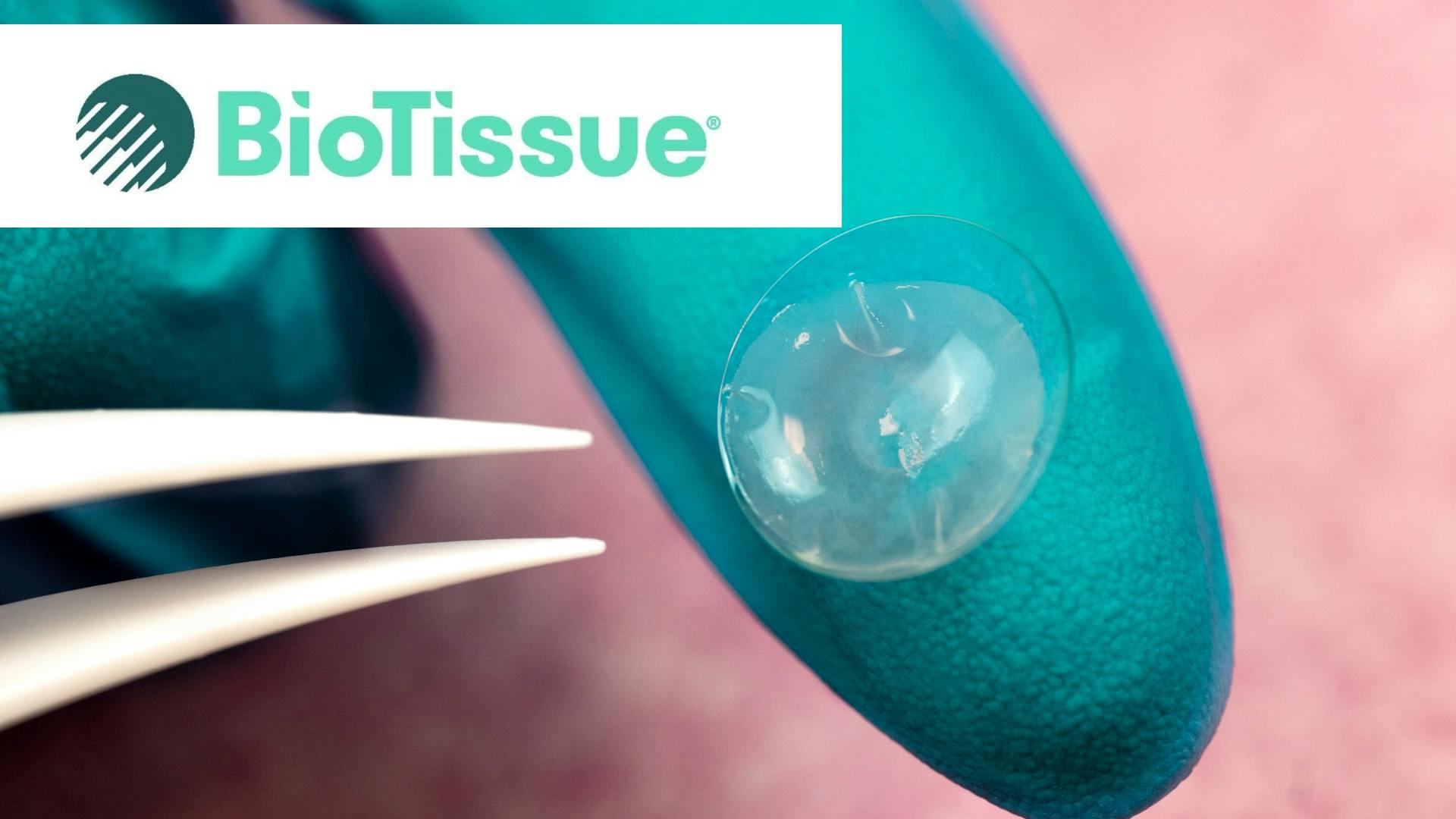 BioTissue Introduces CAM360 AmnioGraft Regenerative Therapy - Eyewire+