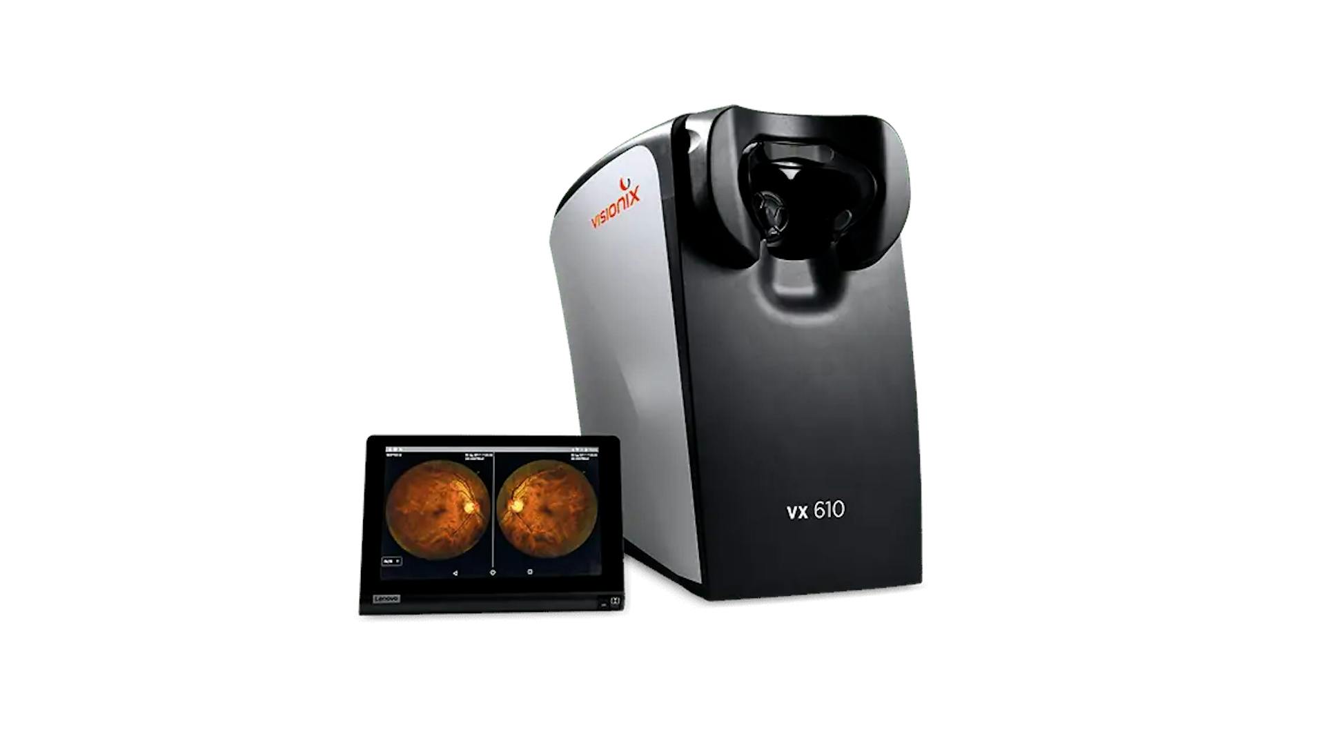Visionix Launches VX 610 Non-Mydriatic Automated Fundus Camera - Eyewire+