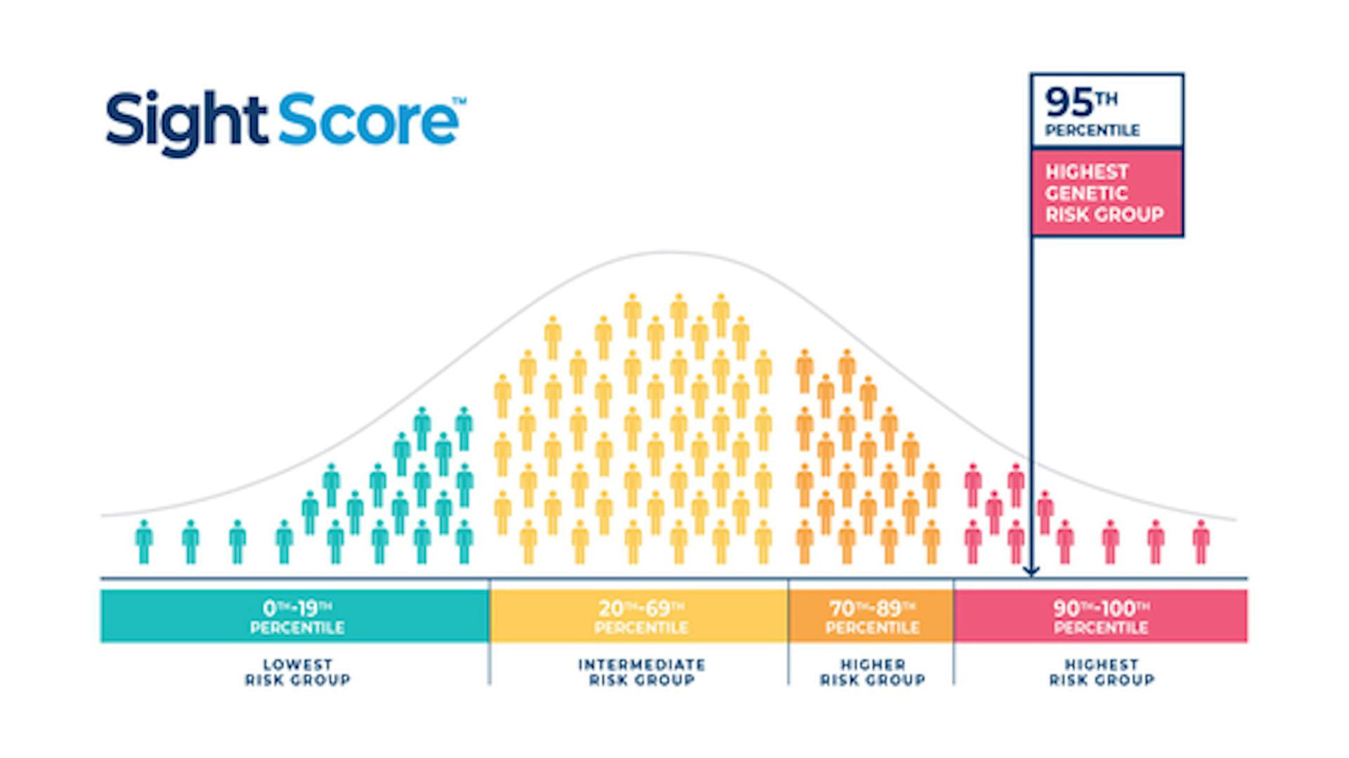 Polygenic Risk Score Test for Glaucoma Released in US - Eyewire+