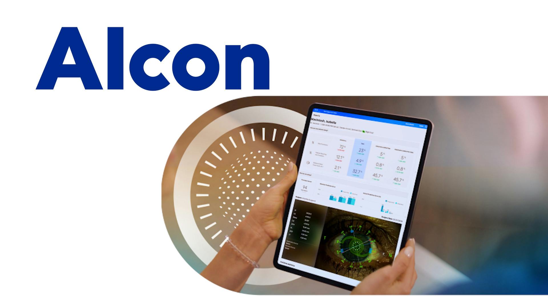 Alcon SMARTCataract - Eyewire+