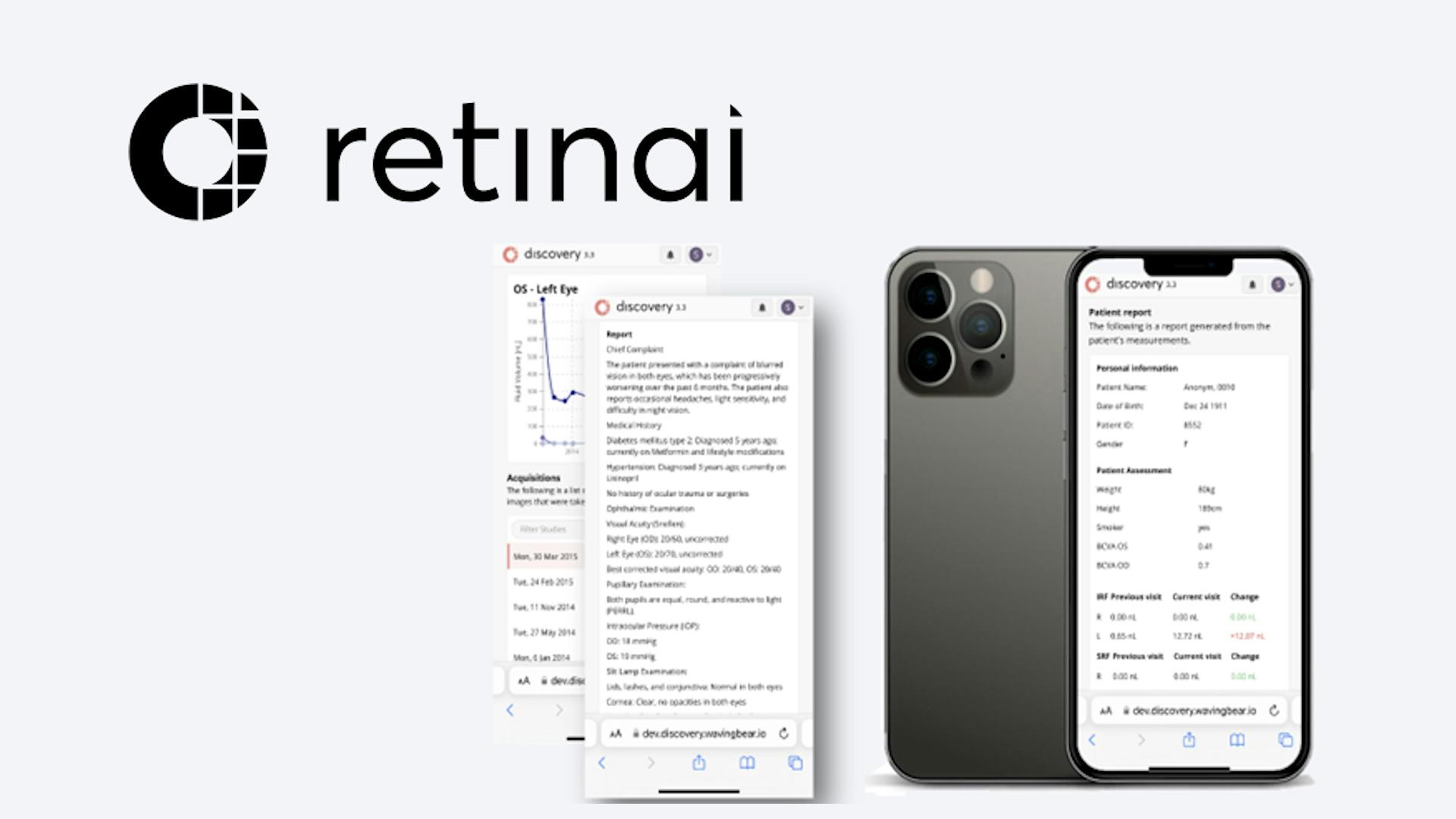 RetinAI Launches AI-Based Platform for Ophthalmology and Optometry ...