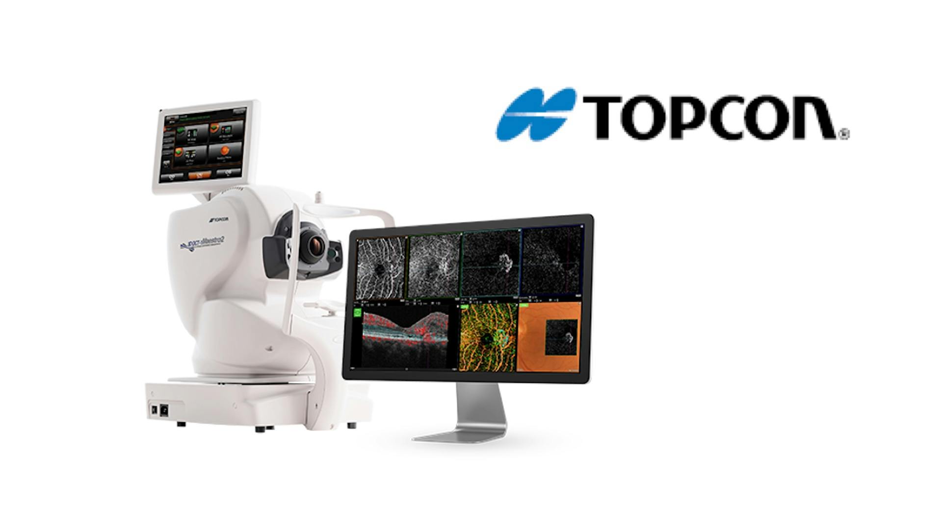 FDA Clears OCTA on Topcon's Maestro2 Fundus Camera System - Eyewire+