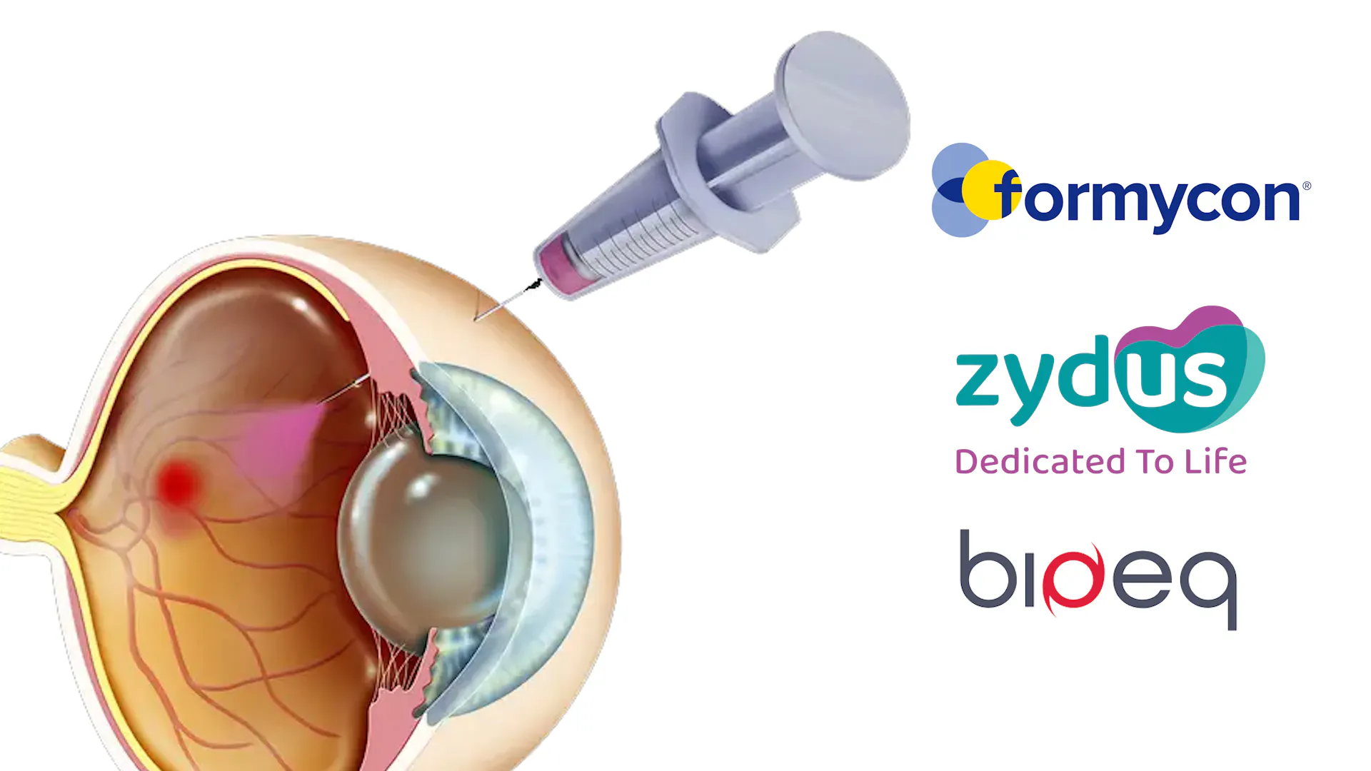 Lucentis Biosimilar Nufymco Approved by FDA - Eyewire+
