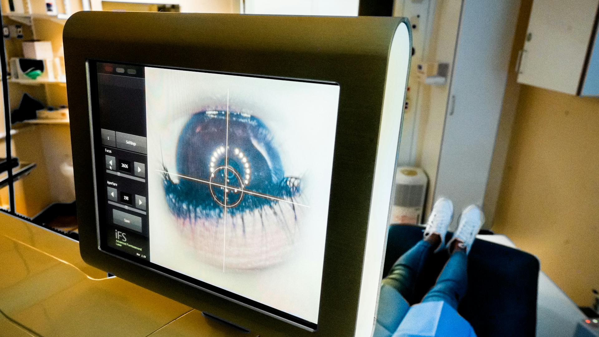 Potential New Method for Treating Keratoconus - Eyewire+