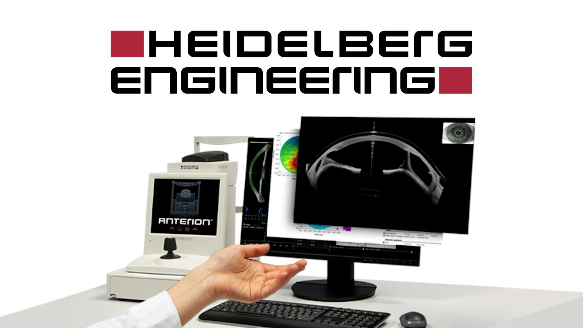 Heidelberg Engineering Anterion - Eyewire+