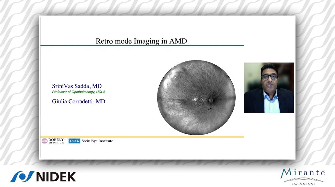 Multimodal Retinal Imaging of AMD Using the Mirante SLO - Eyetube