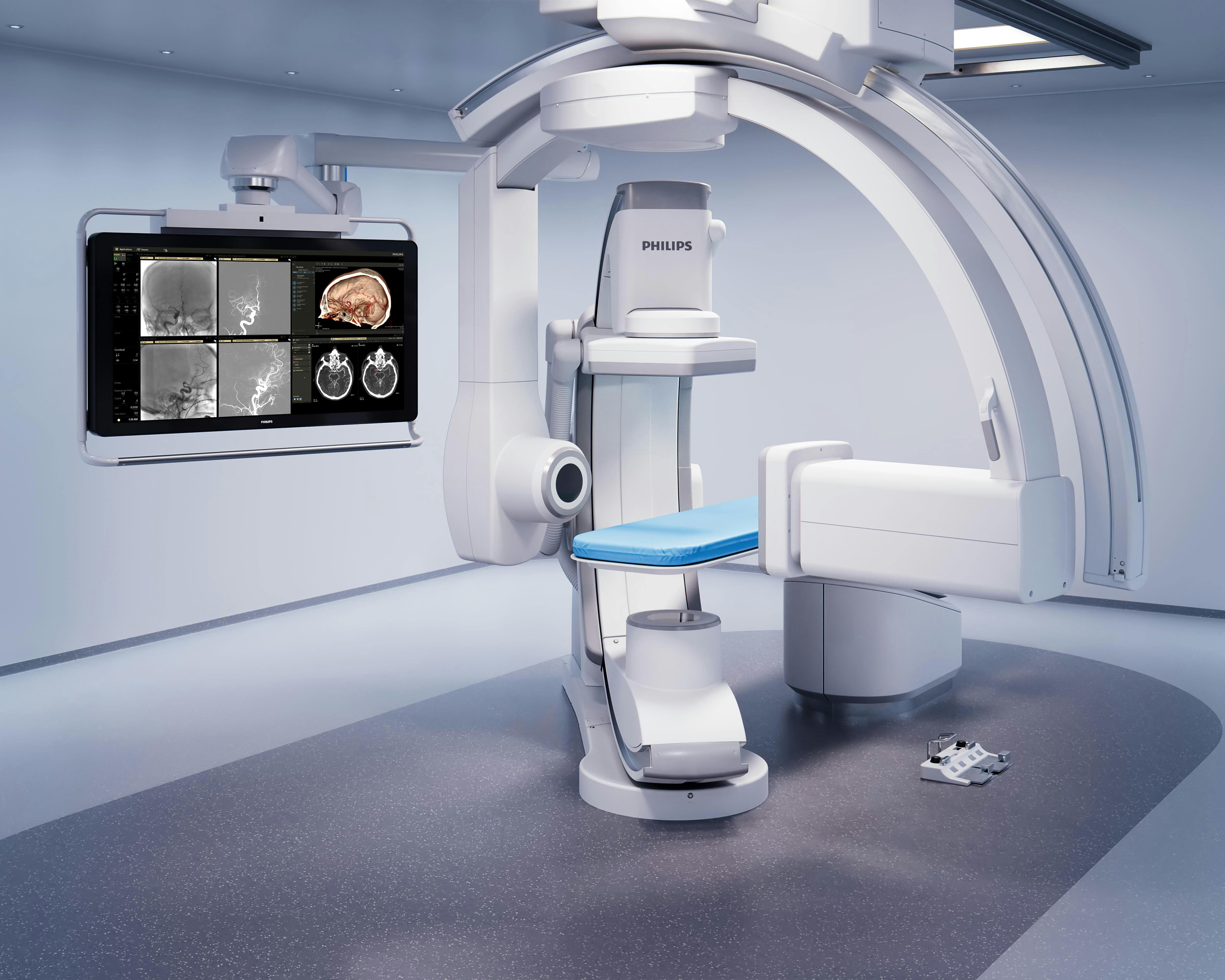 Philips SmartCT for Stroke Imaging Launched in Europe - Endovascular Today