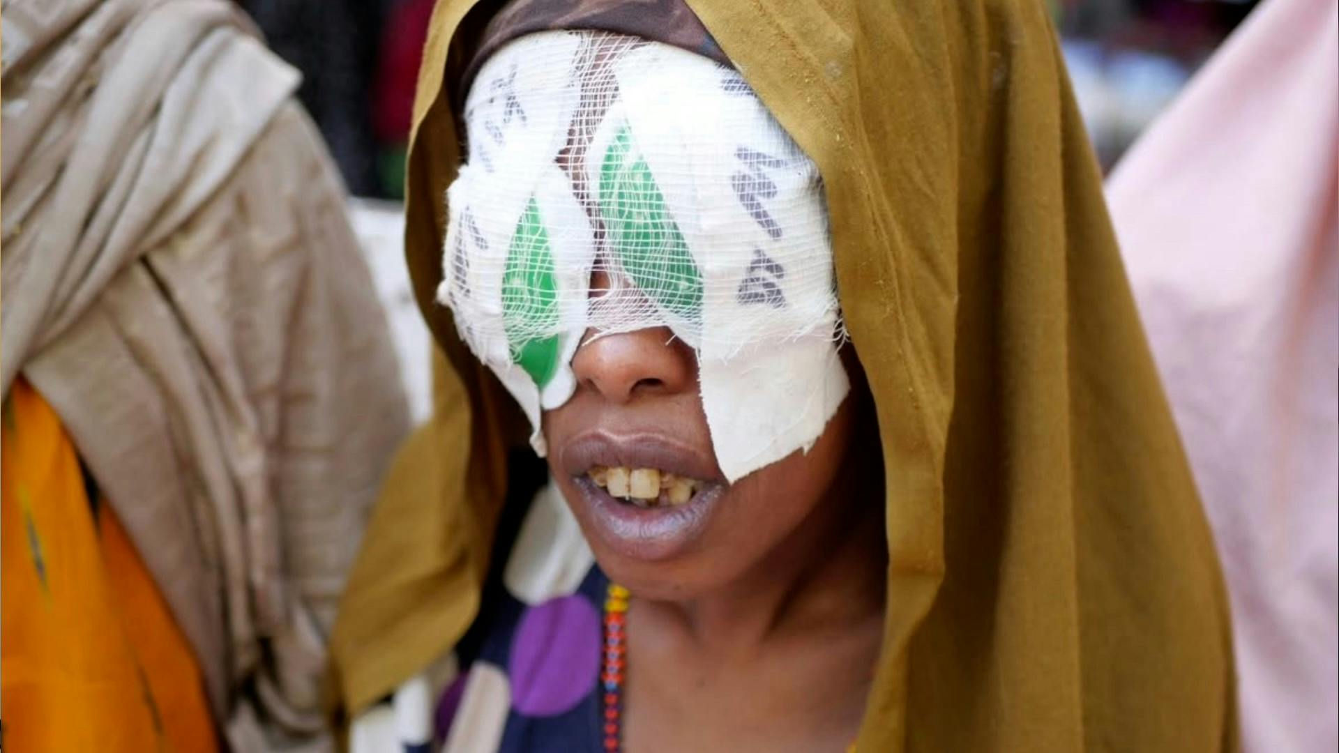 Increasing Access to Care - Eyewire+