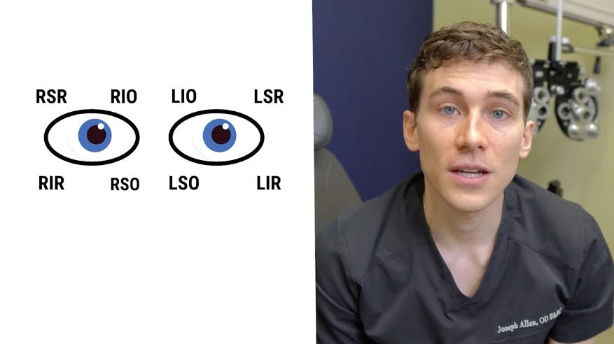 Recognizing and Treating Paralysis of the Trochlear Nerve - Eyetube