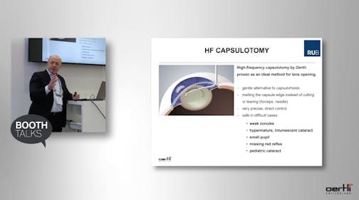 Combined Implantation of Carlevale FIL SSF IOL and Artificial Iris ...