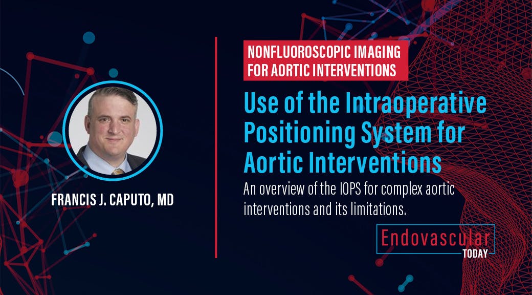 Use of the Intraoperative Positioning System for Aortic Interventions ...